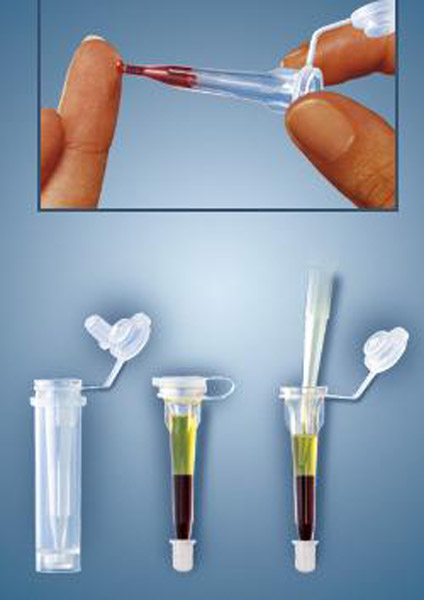 Microvette® 300 Lithium Heparin - Vet Tech